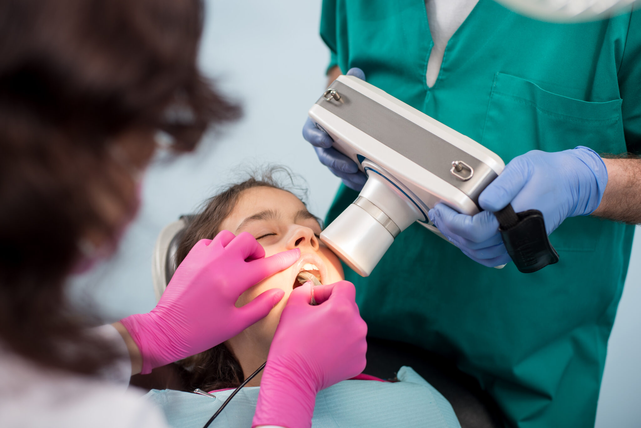 Fighting Cavities: The Science Behind Dental Sealants - Stallings Dental